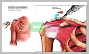 Acromion Bone Image | Anatomy System - Human Body Anatomy diagram and chart images