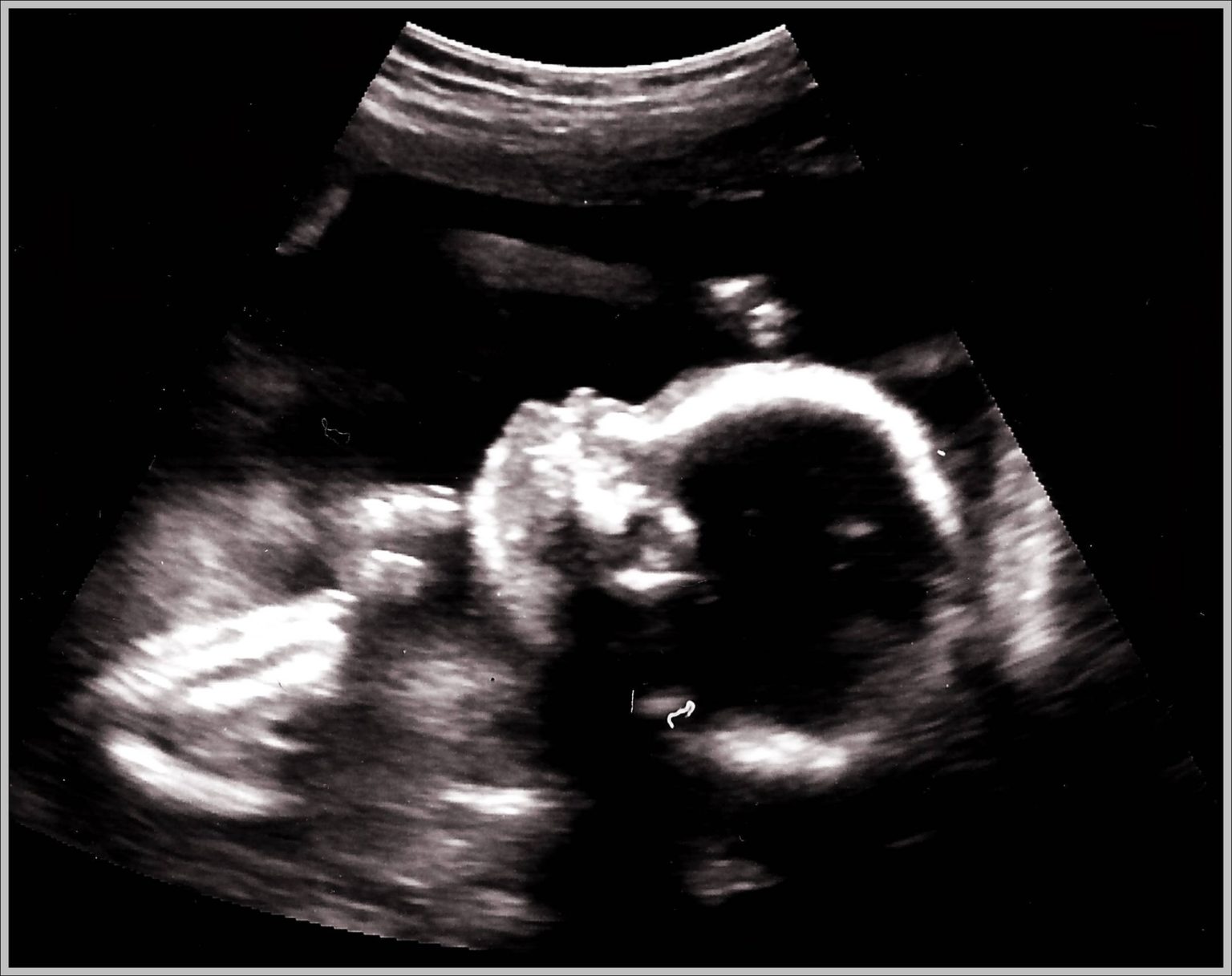 Bsn To Np Image | Anatomy System - Human Body Anatomy diagram and chart ...