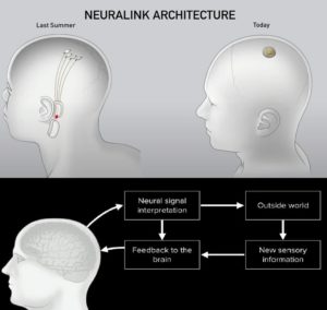 Neuralink Diagram – How it works | Anatomy System - Human Body Anatomy ...