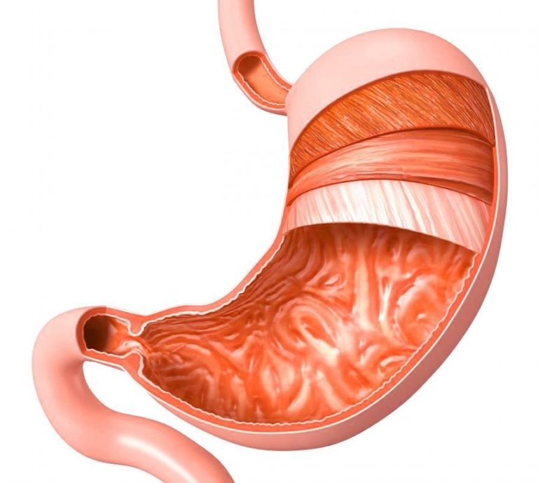 What Causes Gastritis | Anatomy System - Human Body Anatomy diagram and ...