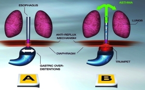 asthma explained | Anatomy System - Human Body Anatomy diagram and ...