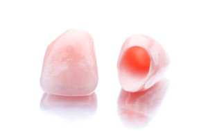 crowns bridges crowns | Anatomy System - Human Body Anatomy diagram and ...