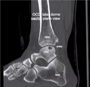 ct ocd mod | Anatomy System - Human Body Anatomy diagram and chart images