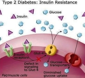 diabetes mellitus type | Anatomy System - Human Body Anatomy diagram ...