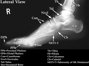 foot normal lat xray | Anatomy System - Human Body Anatomy diagram and ...