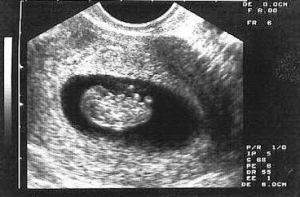 scan weeks | Anatomy System - Human Body Anatomy diagram and chart images