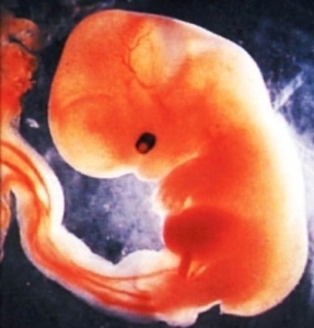 the gender of child determined at weeks of pregnancy | Anatomy System ...